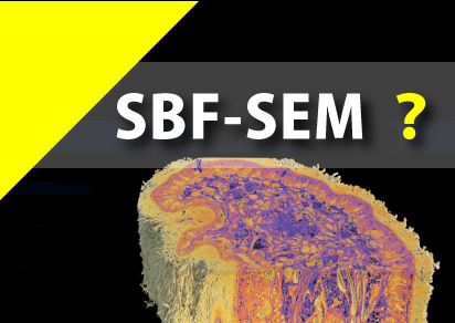 SBF-SEMとは？ - 研究用精密機器販売のメイワフォーシス株式会社